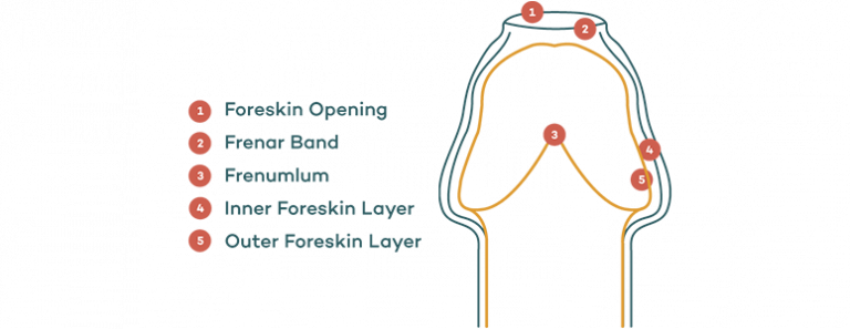 How can you tell if balanitis is fungal or bacterial? | Healthy Male