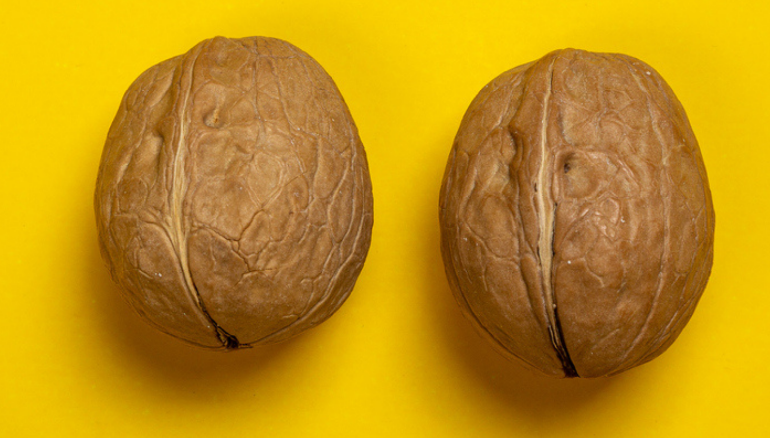 Is the whole testicle removed when you have testicular cancer?