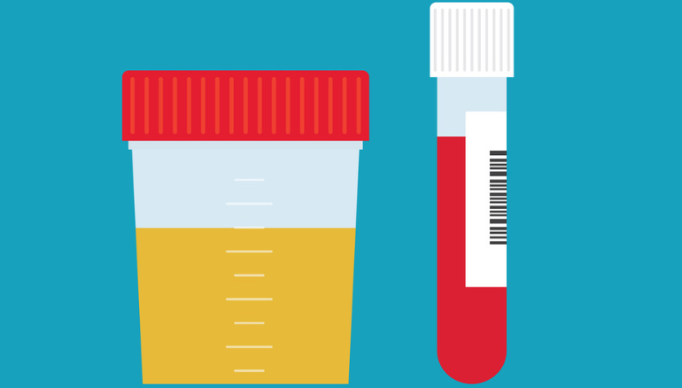 How Do I Get Tested For Sexually Transmitted Infections Stis