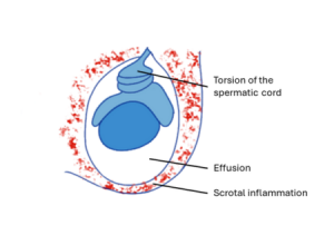Child and adolescent male genital examination clinical summary guide ...