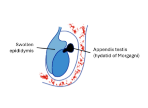 Child and adolescent male genital examination clinical summary guide ...